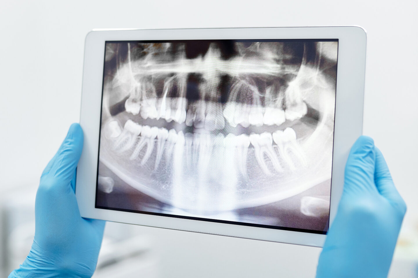 Radiografia - Odontoiatria Trentina
